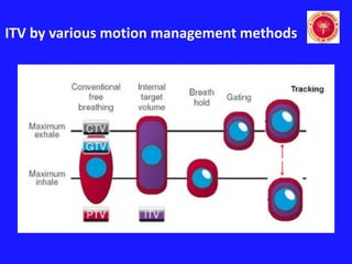 ABC system, Free Breath 4DCT & Symmetry Radiotherapy | PDF