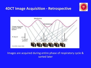 ABC system, Free Breath 4DCT & Symmetry Radiotherapy | PPT