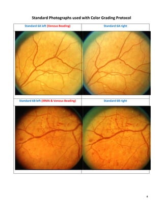 Dr screening training for nurses standard photographs used with color ...