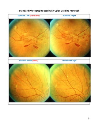 Dr screening training for nurses standard photographs used with color ...
