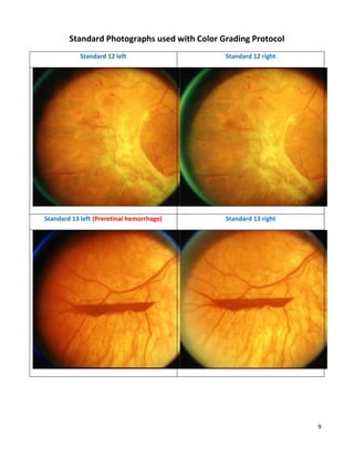 Dr screening training for nurses standard photographs used with color ...