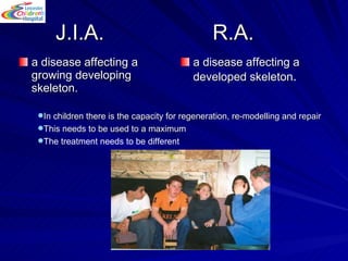 Dr shridhar jia children and young people with arthritis.ppt