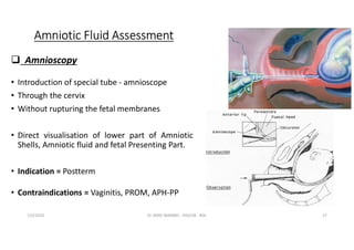 Dr Simo - Fetal Distress and Neonatal Asphyxia.pdf