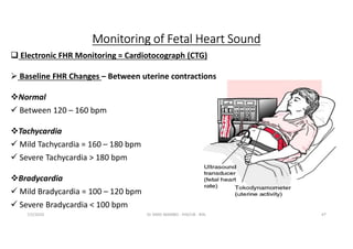 Dr Simo - Fetal Distress and Neonatal Asphyxia.pdf