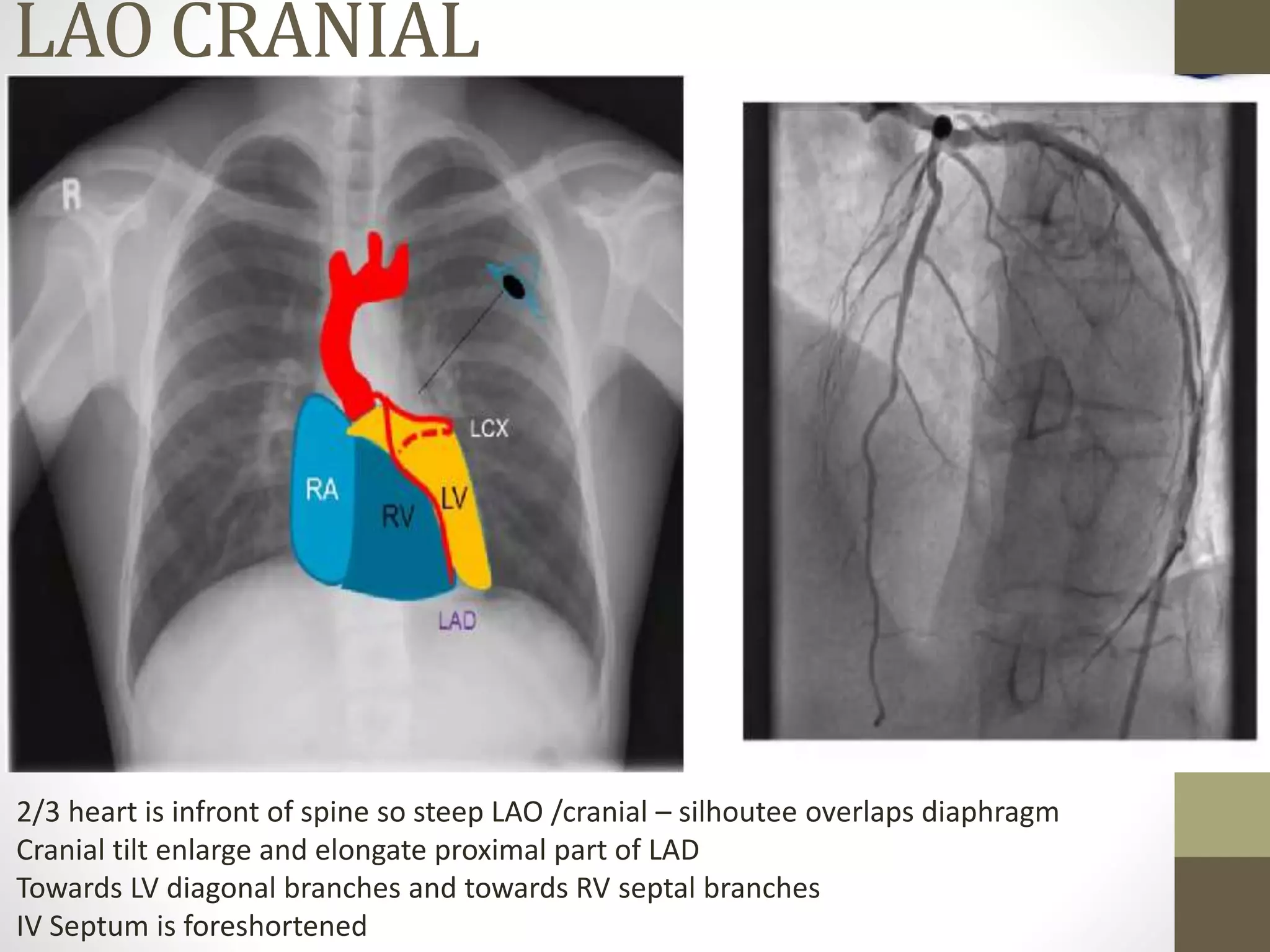 CARDIAC ANATOMY BY DR SIVA PATEL | PPTX