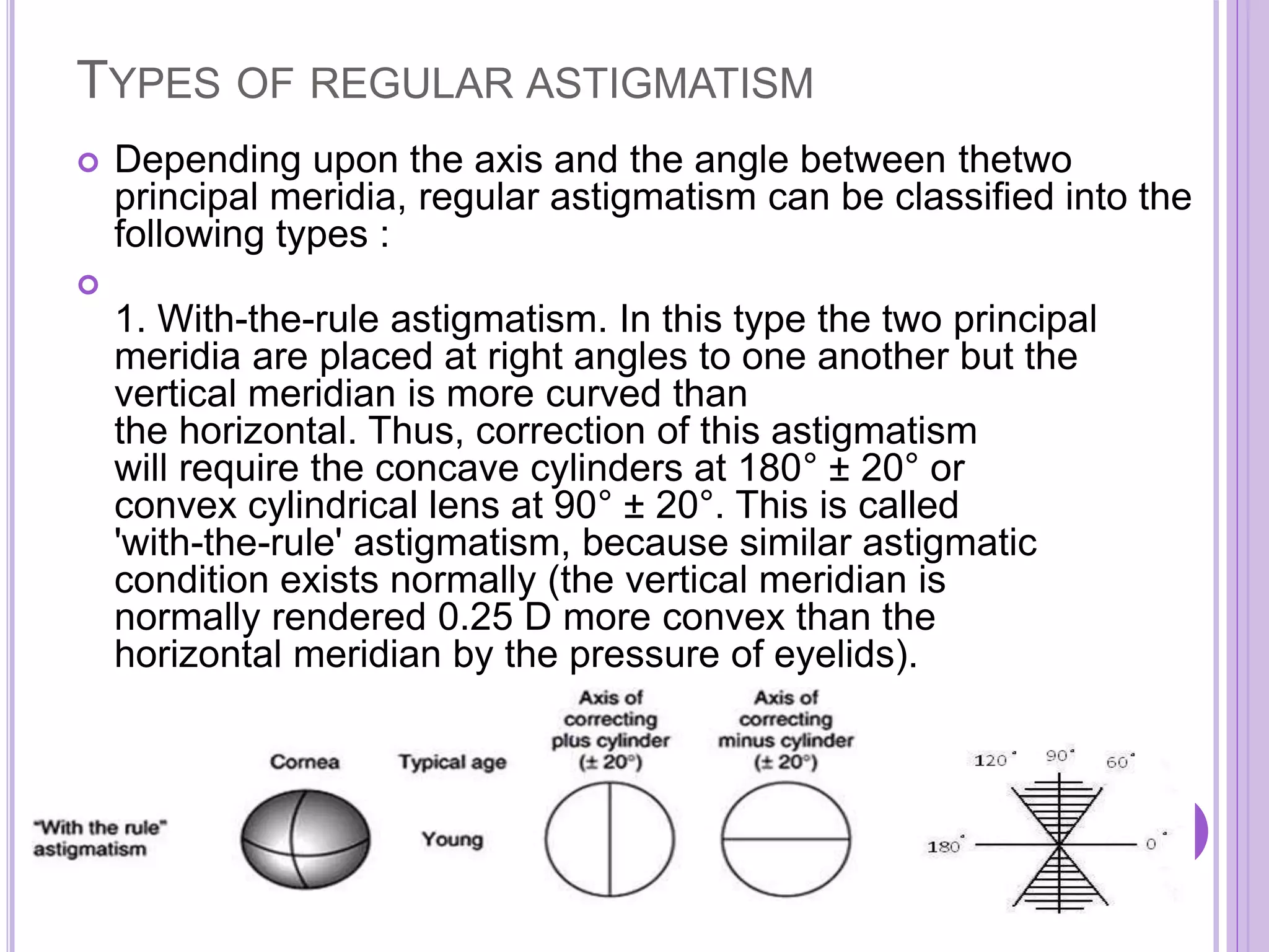 DR SONAL Myopia and astigmatism.pptx | Eye and Vision Conditions ...