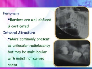 unilocular and multilocular radiolucencies | PPTX