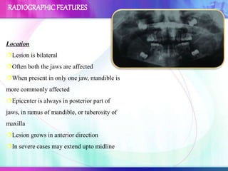 unilocular and multilocular radiolucencies | PPTX