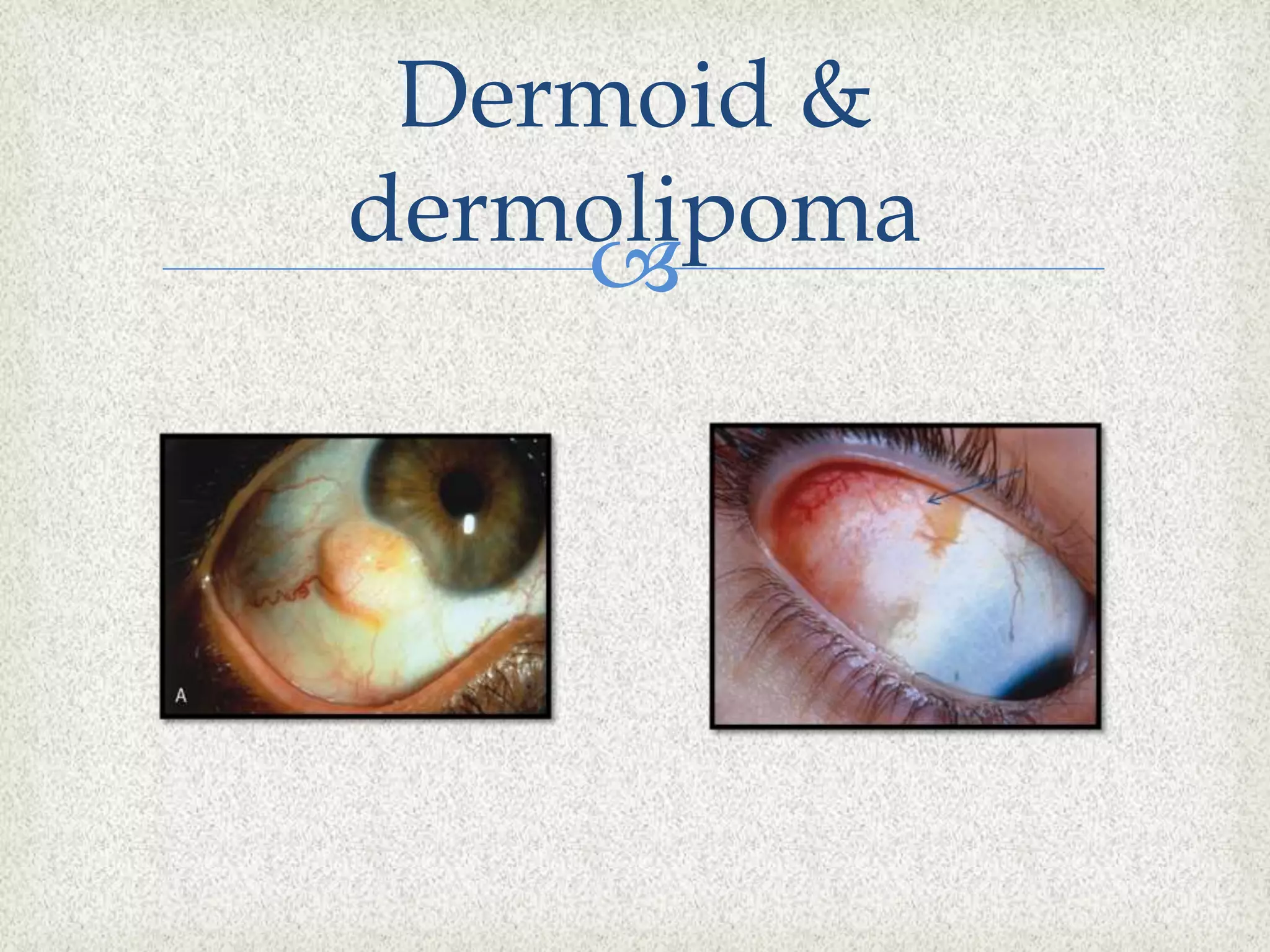 Dr.s.veni priya 18.2.16 deg cyst tumors | PPTX