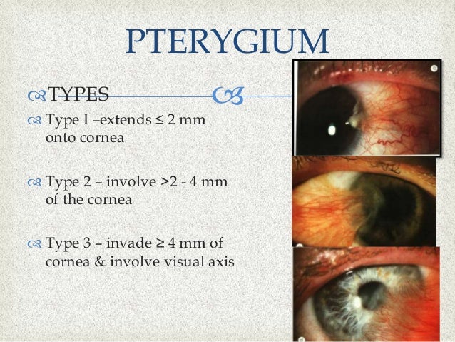 Dr.s.veni priya 18.2.16 deg cyst tumors