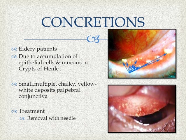 Dr.s.veni priya 18.2.16 deg cyst tumors