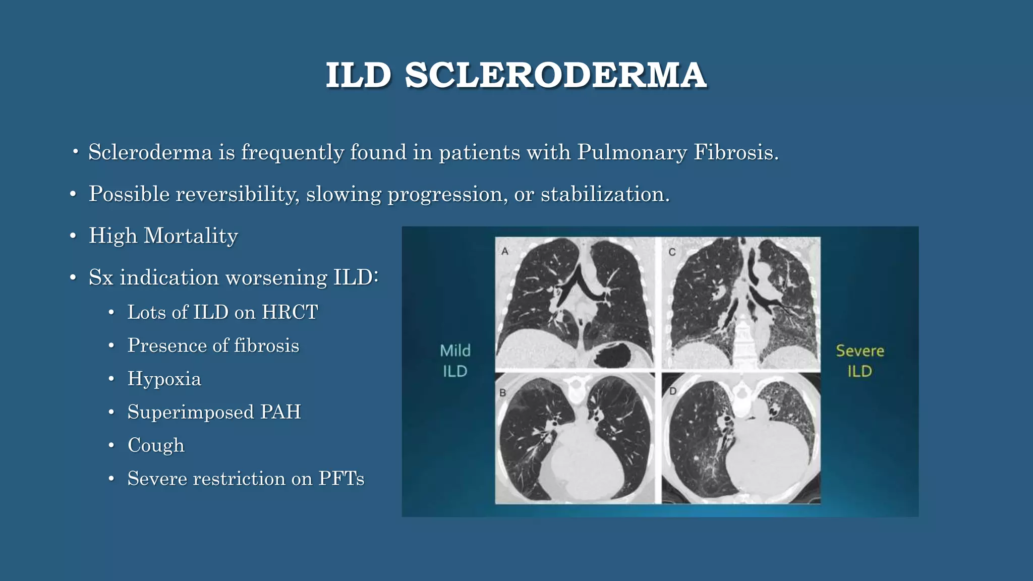 Scleroderma Overview & Insights | PPT