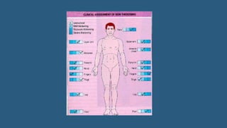 Scleroderma Overview & Insights | PPT