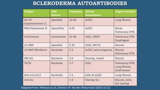 Scleroderma Overview & Insights | PPT
