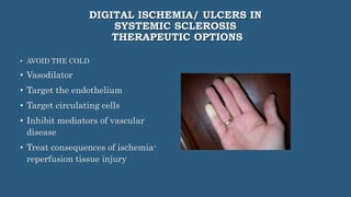 Scleroderma Overview & Insights | PPT