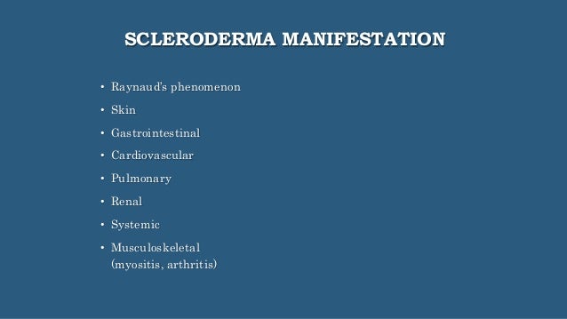 Scleroderma Overview & Insights