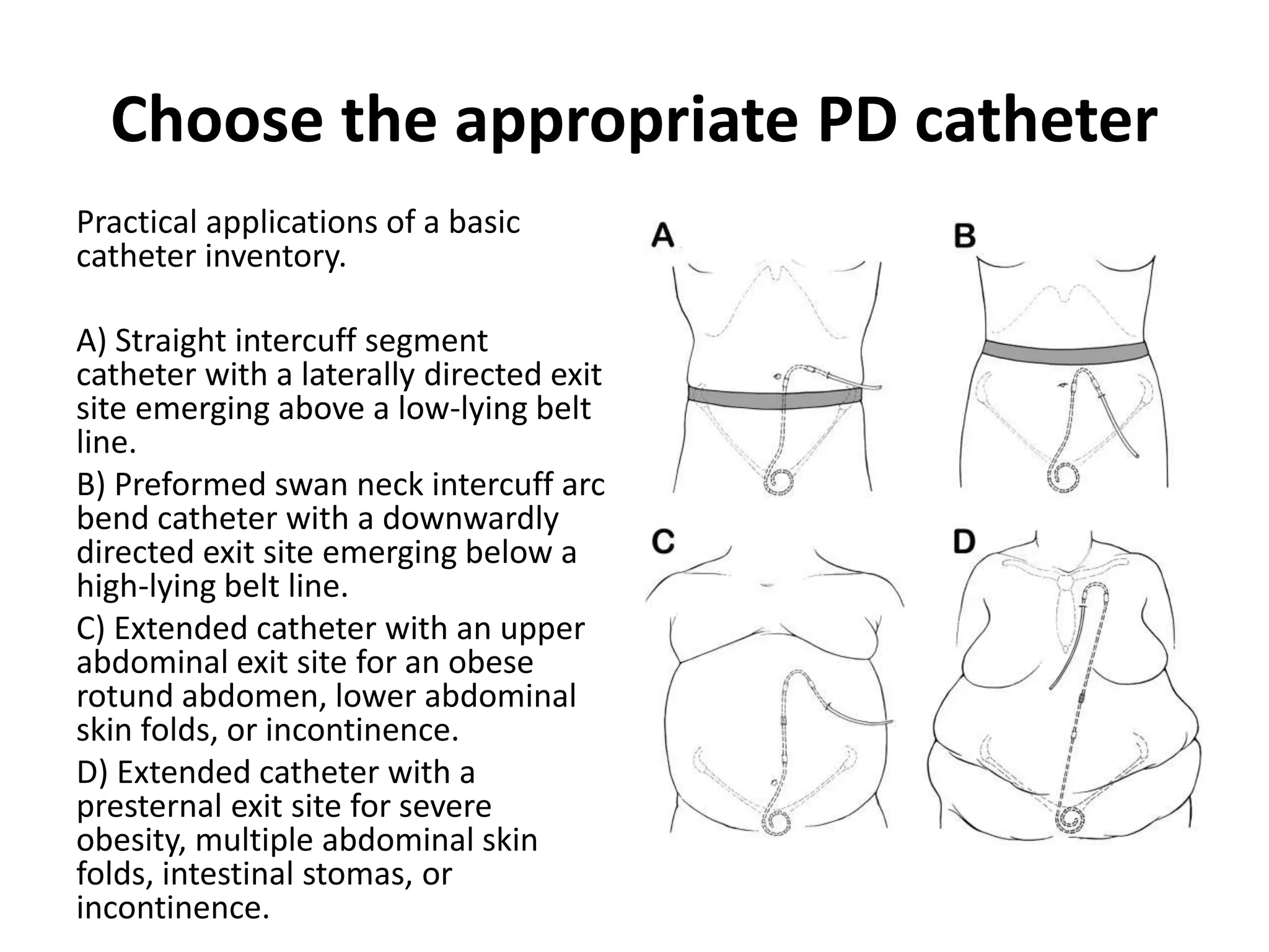 Dr tamer el said pd catheter insertion | PPTX