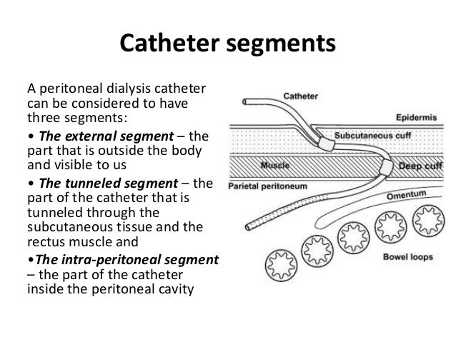 Dr tamer el said pd catheter insertion