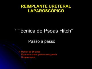 REIMPLANTE URETERAL | PPT