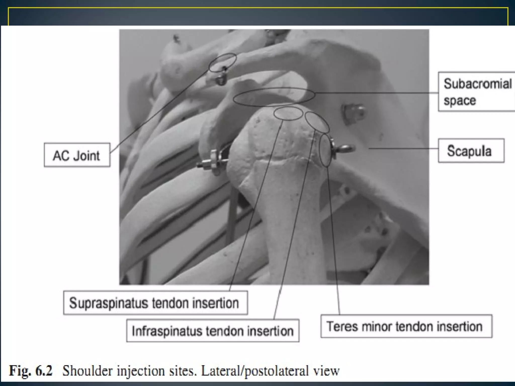 Dr tarek joint and soft tissue injections (1) | PPT
