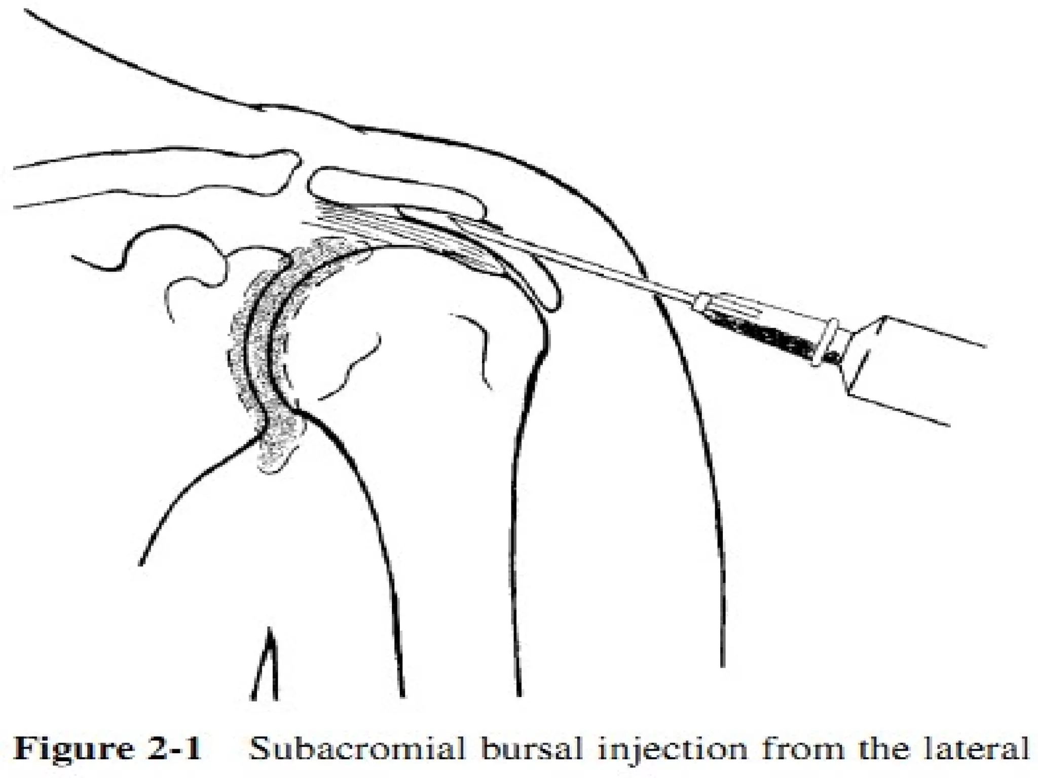 Dr tarek joint and soft tissue injections (1) | PPT