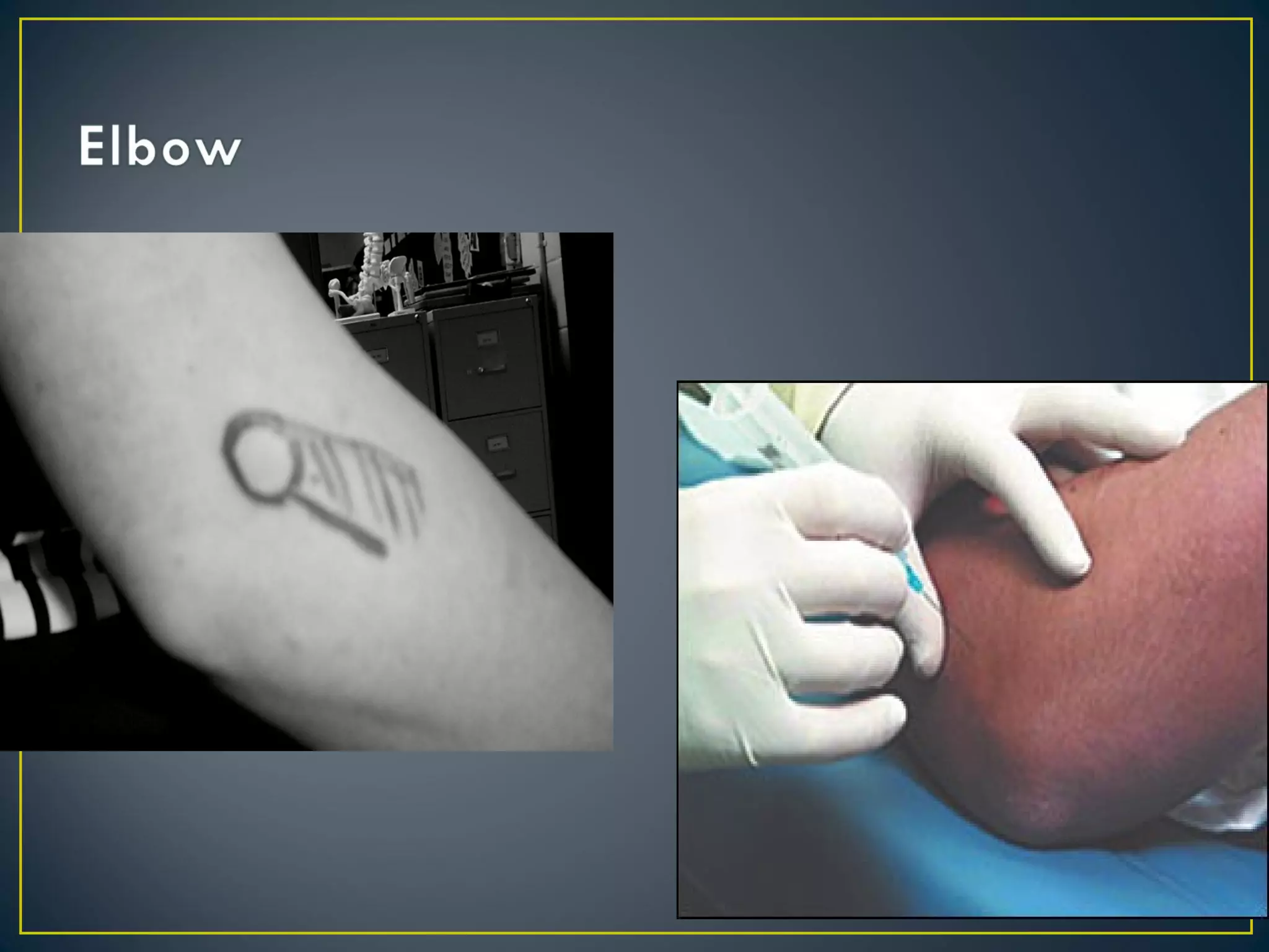 Dr tarek joint and soft tissue injections (1) | PPT