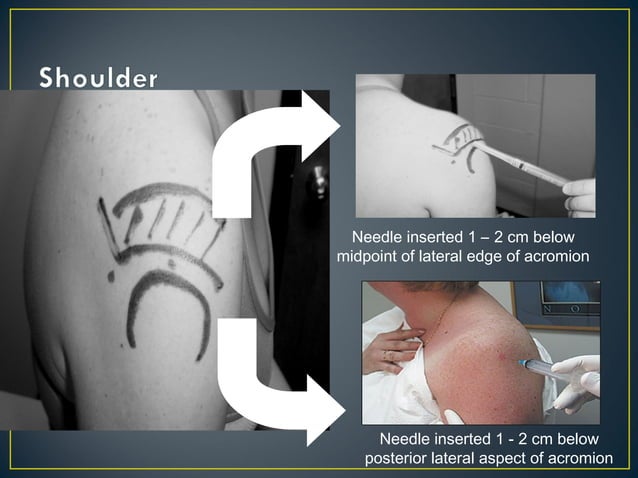 Dr tarek joint and soft tissue injections (1) | PPT