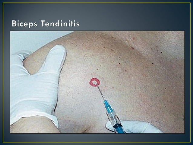 Dr tarek joint and soft tissue injections (1) | PPT