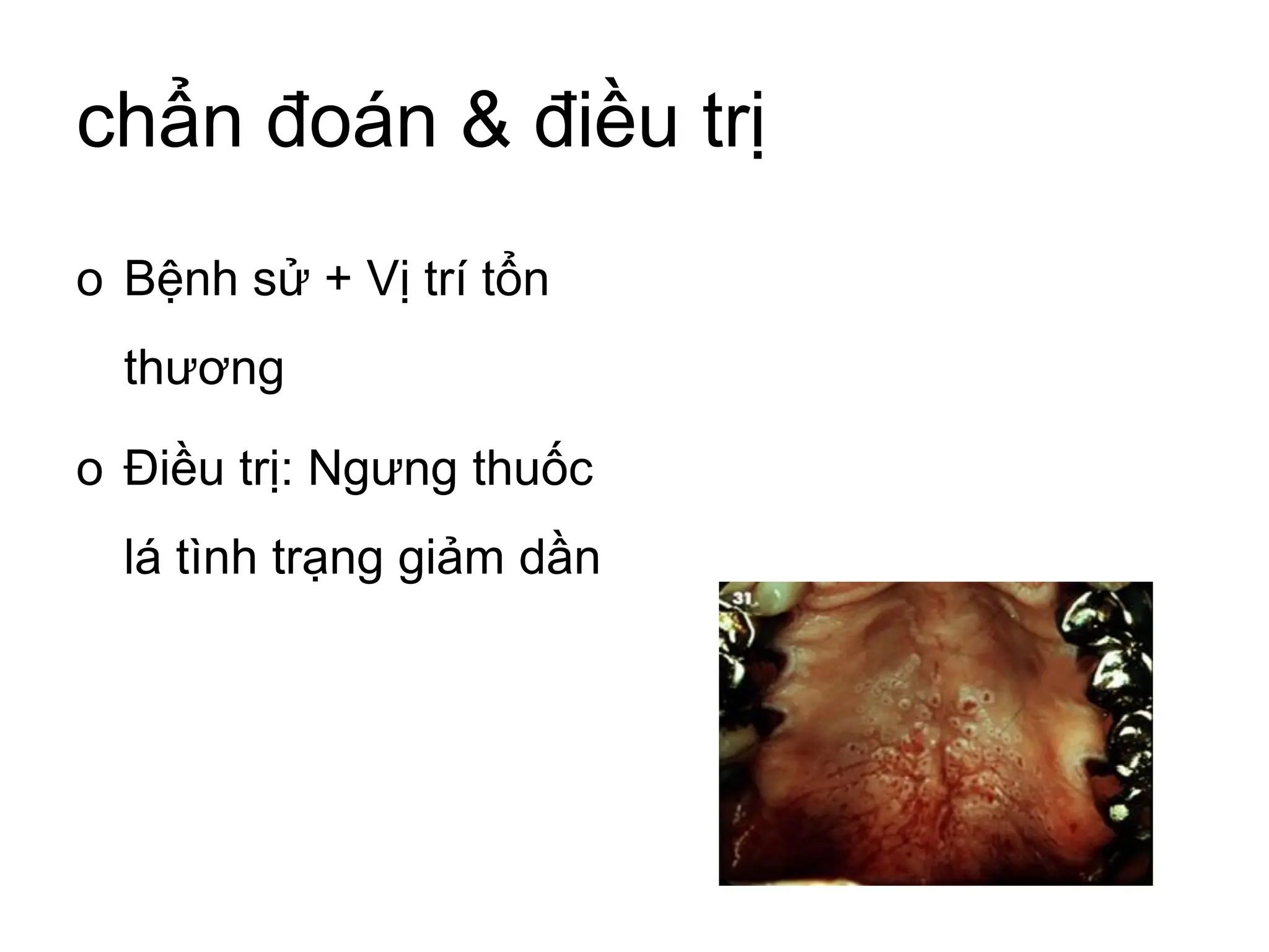 Chan doan dieu tri mot so ton thuong benh hoc mieng | PDF