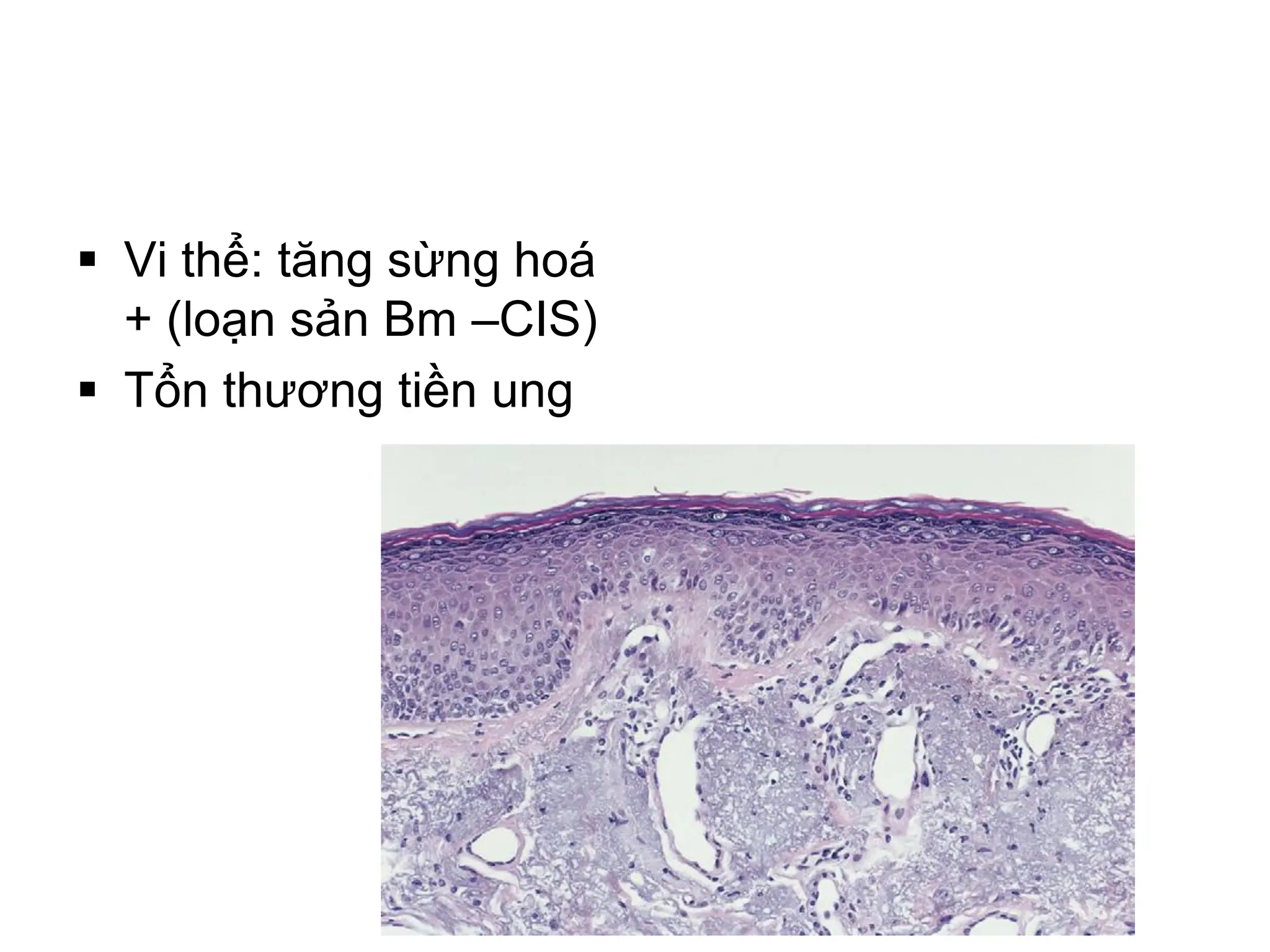Chan doan dieu tri mot so ton thuong benh hoc mieng | PDF