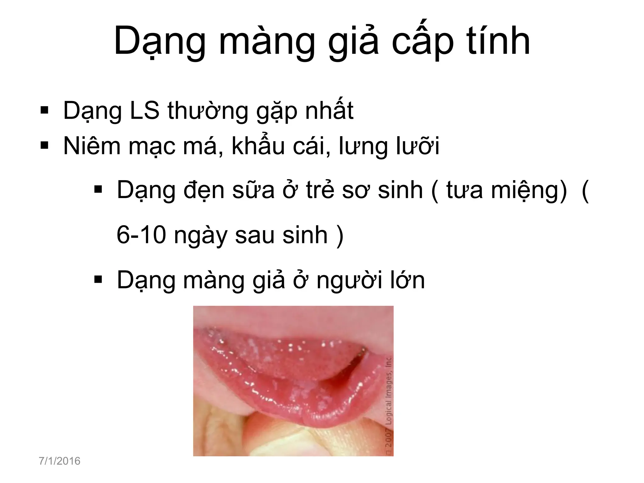 Chan doan dieu tri mot so ton thuong benh hoc mieng | PDF