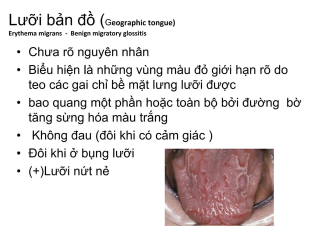 Chan doan dieu tri mot so ton thuong benh hoc mieng | PDF