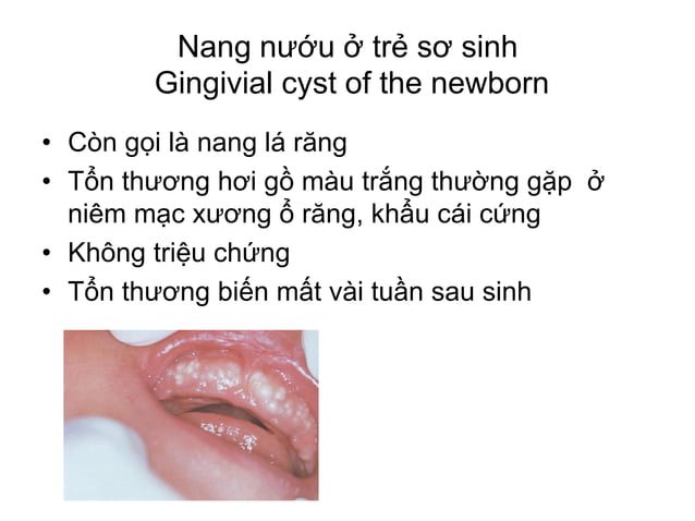 Chan doan dieu tri mot so ton thuong benh hoc mieng | PDF