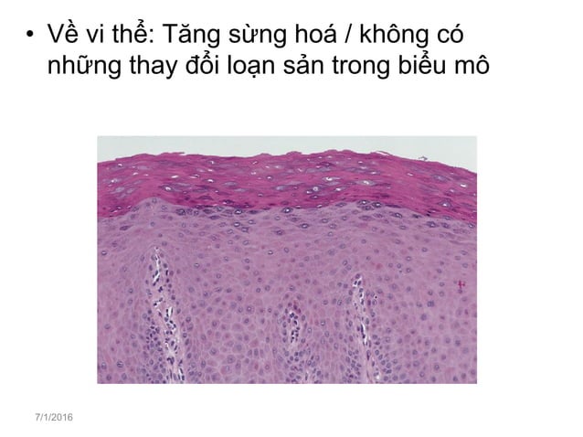 Chan doan dieu tri mot so ton thuong benh hoc mieng | PDF