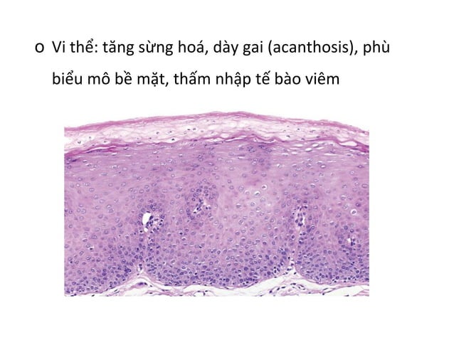 Chan doan dieu tri mot so ton thuong benh hoc mieng | PDF
