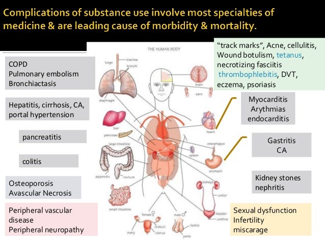Drug abuse complications