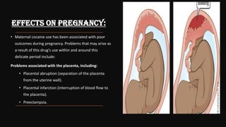 Drug Abuse During Pregnancy and their effects on body | PDF