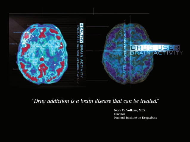 Drug Abuse & Recovery.pdf | Illegal Drugs, Tobacco, eCigarettes, Vaping ...