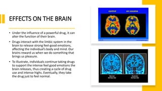 Drug addiction (causes and treatment) | PPTX