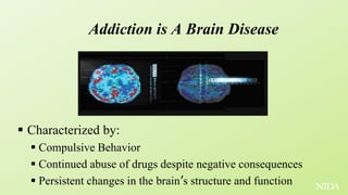 drug addiction as a brain.pptx