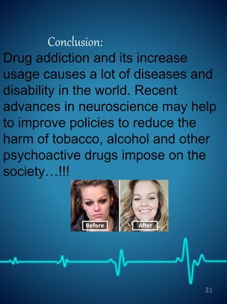 🔥 Summary and conclusion of drug addiction. Summary And Conclusion ...