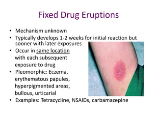 Drug Allergy-Diagnosis and Treatment .ppt