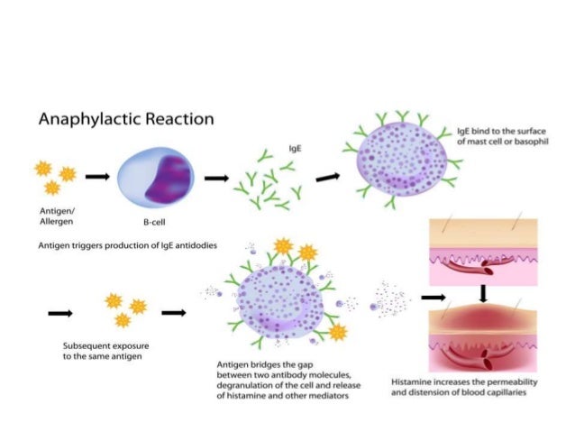 Adverse reaction and drug allergy