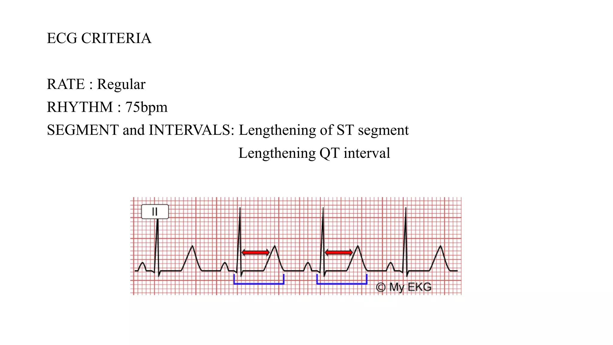 Drug and electrolytes effect on ECG | PPTX