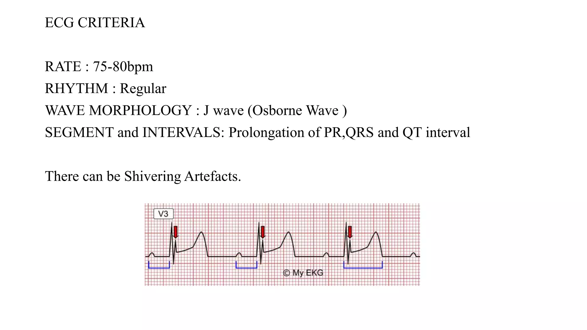 Drug and electrolytes effect on ECG | PPTX