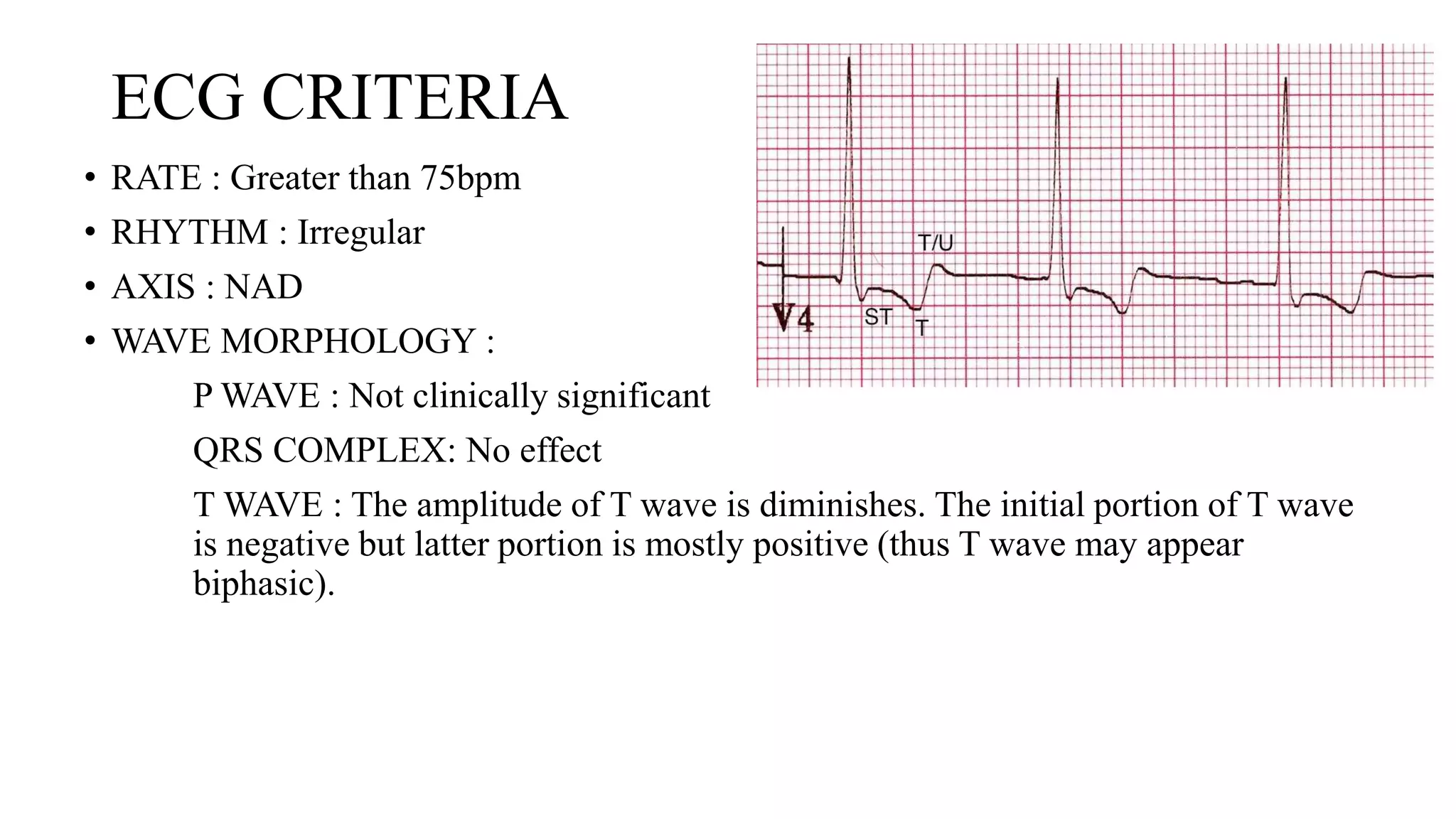 Drug and electrolytes effect on ECG | PPTX
