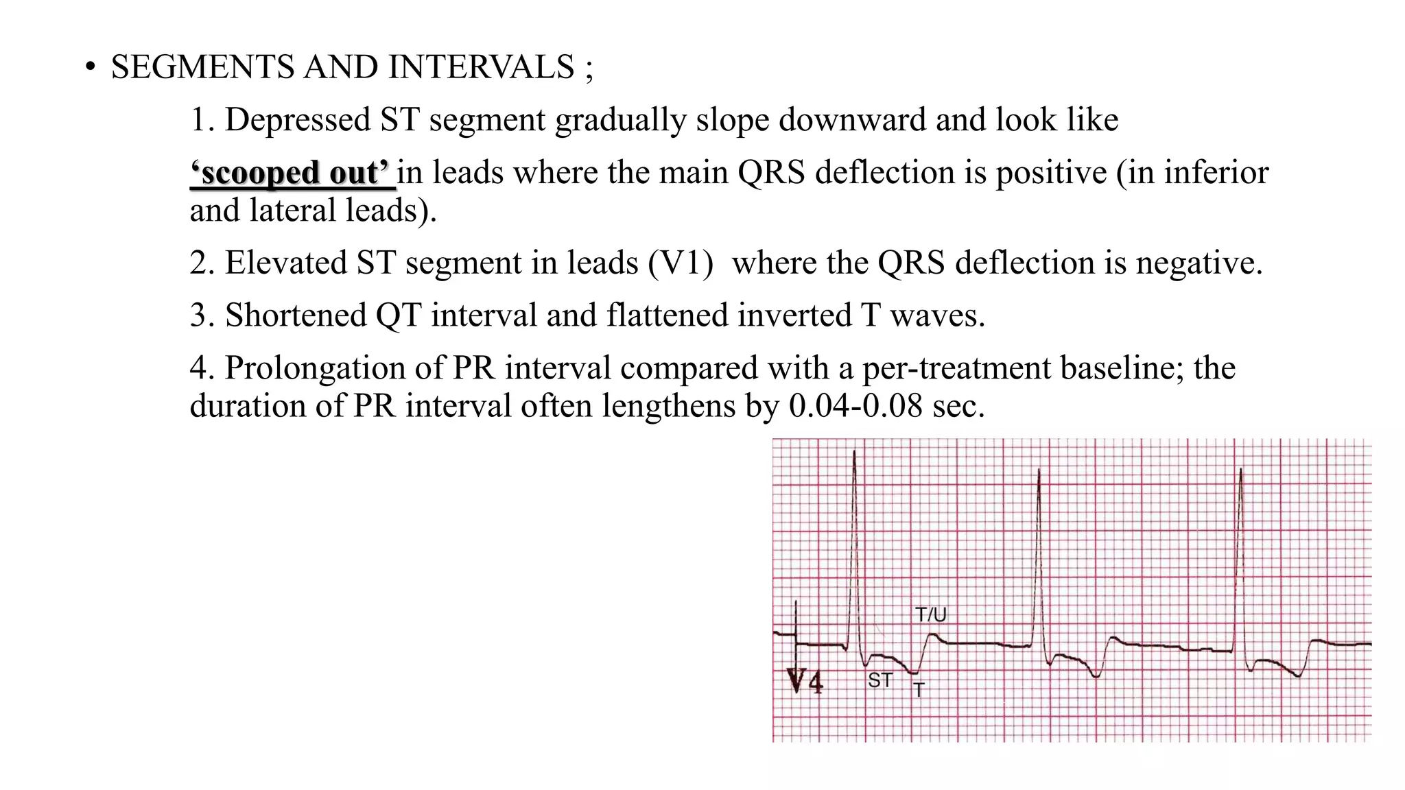 Drug and electrolytes effect on ECG | PPTX