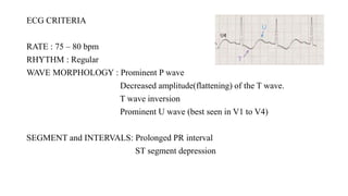 Drug and electrolytes effect on ECG | PPTX