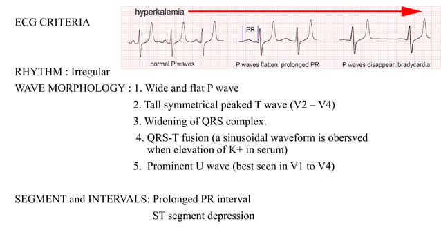 Drug and electrolytes effect on ECG | PPTX | Heart and Cardiovascular ...