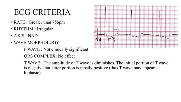 Drug and electrolytes effect on ECG | PPTX | Heart and Cardiovascular ...